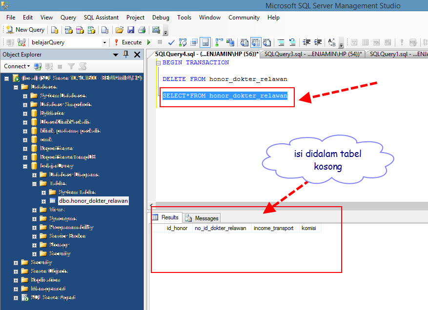 Cara Mengembalikan Data Jika Salah Hapus atau Update di MSSQL | Diary Informatic's