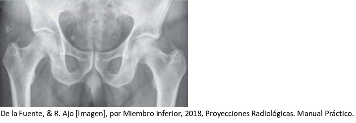PROTOCOLOS DE LOS ESTUDIOS RADIOLÓGICOS CADERA Y PELVIS