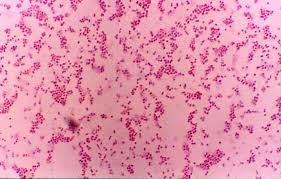 Pasteurella multocida