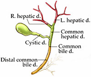 ABC Radiology Blog: Todani Classification Of Bile Duct Cysts