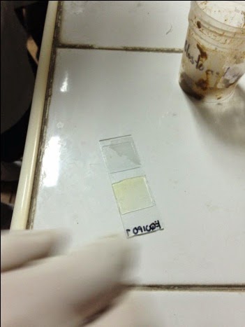 Parasitología: Método de Baermann