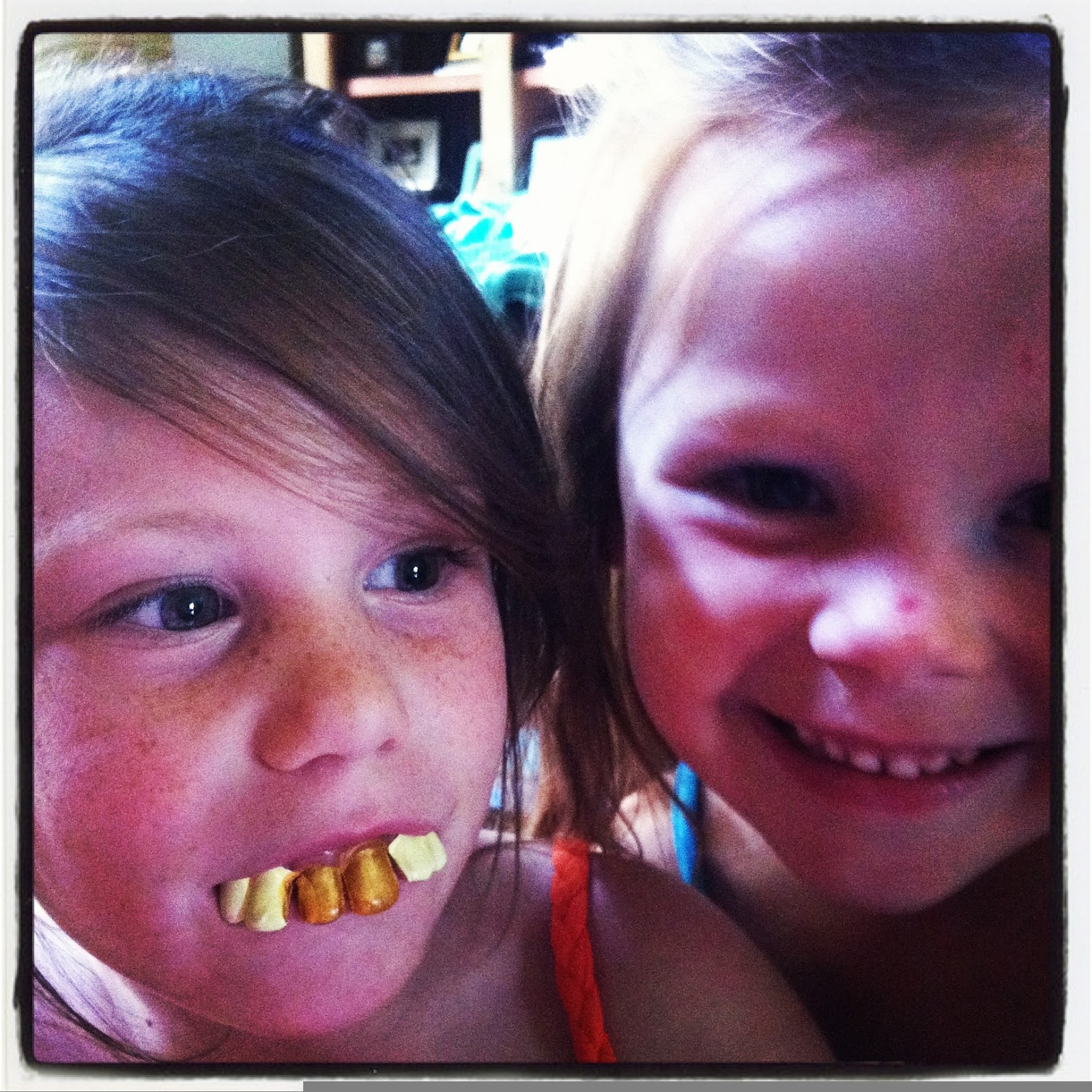 Mojoy: More buckteeth pics. Can you believe it?
