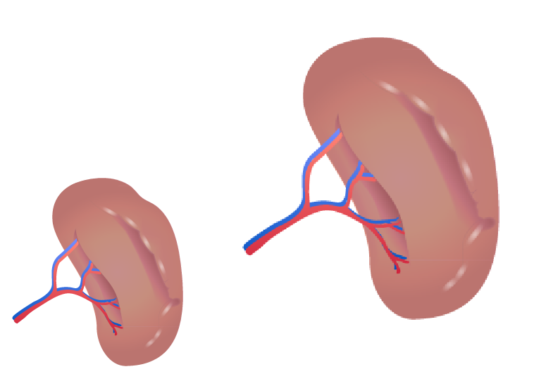 What are the Causes of Enlarged Spleen? | Swami Dayanand Naturopathy ...