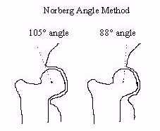Köpeklerde Kalça Displazisi (CANINE HIP DYSPLASIA)