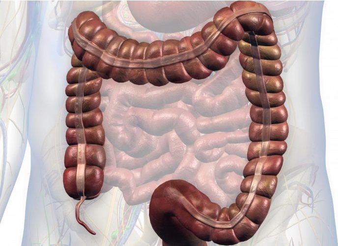 Apendicite - 10 Sintomas Característicos da Doença - Saúde & Conhecimento