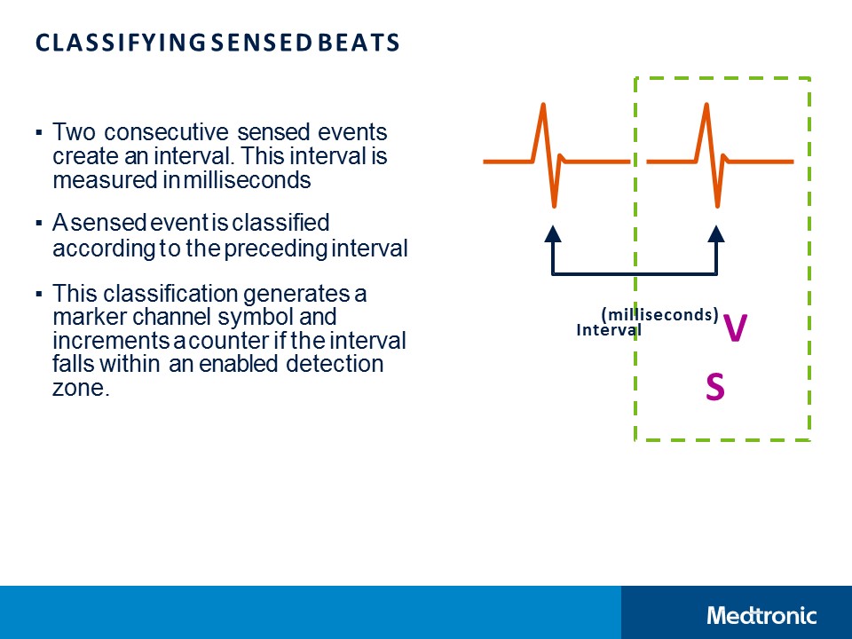CVT Mohd Farid: Concept Of ICD Technology-Sensing & Detection-Medtronic ...