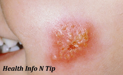 All About Common Skin Disorders