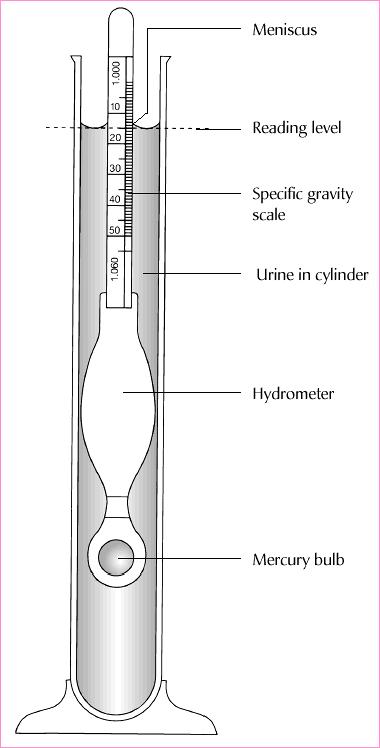 Biochemistry Class notes: Urinalysis: Collection, Preservation and ...