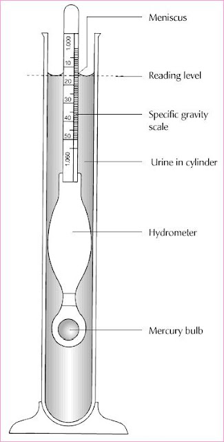 Biochemistry Class notes: Urinalysis: Collection, Preservation and ...