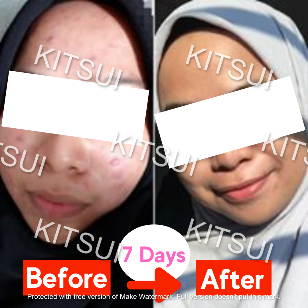 KITSUI WHITEBERRIES BB BEAUTE & KITSUI FEDLOSS FIBRE D'TOX | ZAZA'S REVIEW