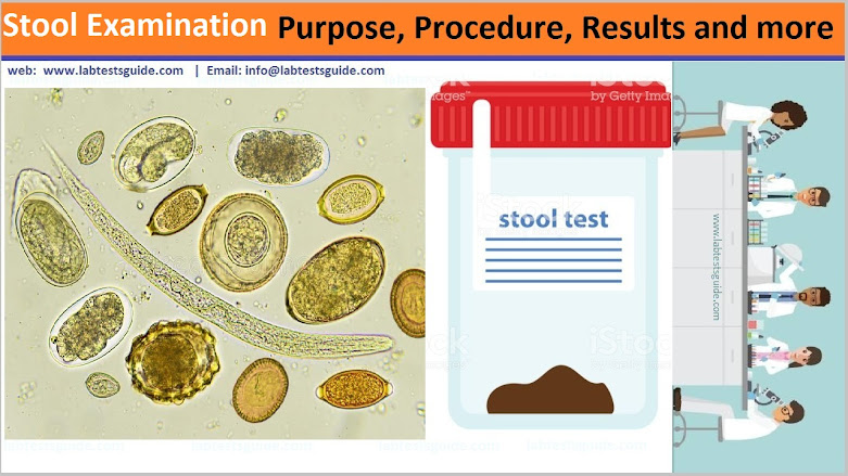 تحليل البراز والديدان والطفيلياتstool analysis - lab for arab
