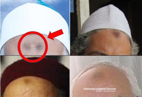 AWAS! Hitam Di Dahi Tanda RIAK & Solat Tak KHUSYUK? ini Penjelasan ...