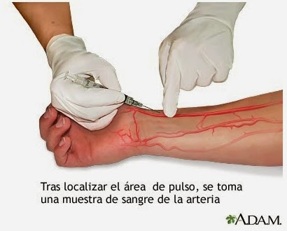 blog EAAIII digital: TÉCNICA DE TOMA DE GASES ARTERIALES (PROCEDIMIENTO)