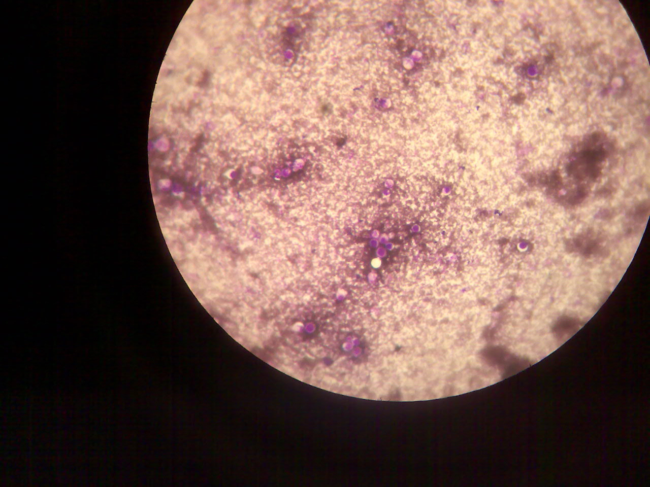 Cryptococcus neoformans | Medik Bloglist