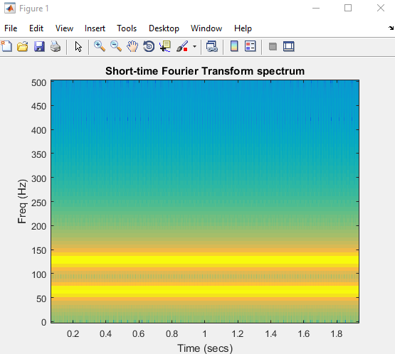 Short-time Fourier Transform spectrum in MATLAB - MATLAB Programming Short-time Fourier Transform spectrum in MATLAB - MATLAB Programming