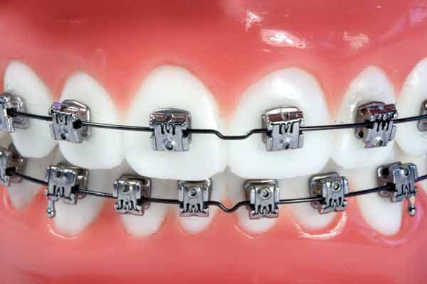 Nibelth Dental Aesthetic: 2015