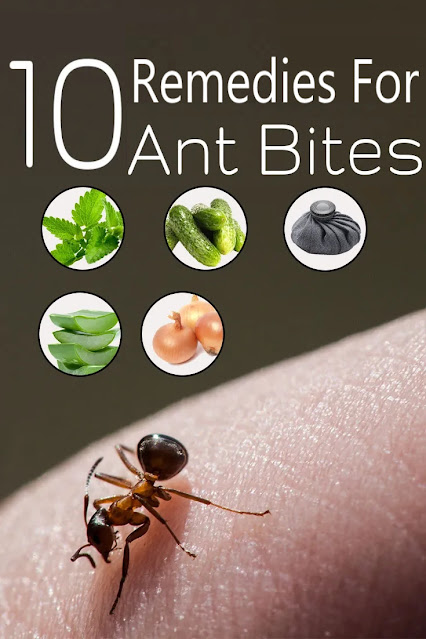 10 Soothing Home Remedies For Ant Bites - wellness magazine