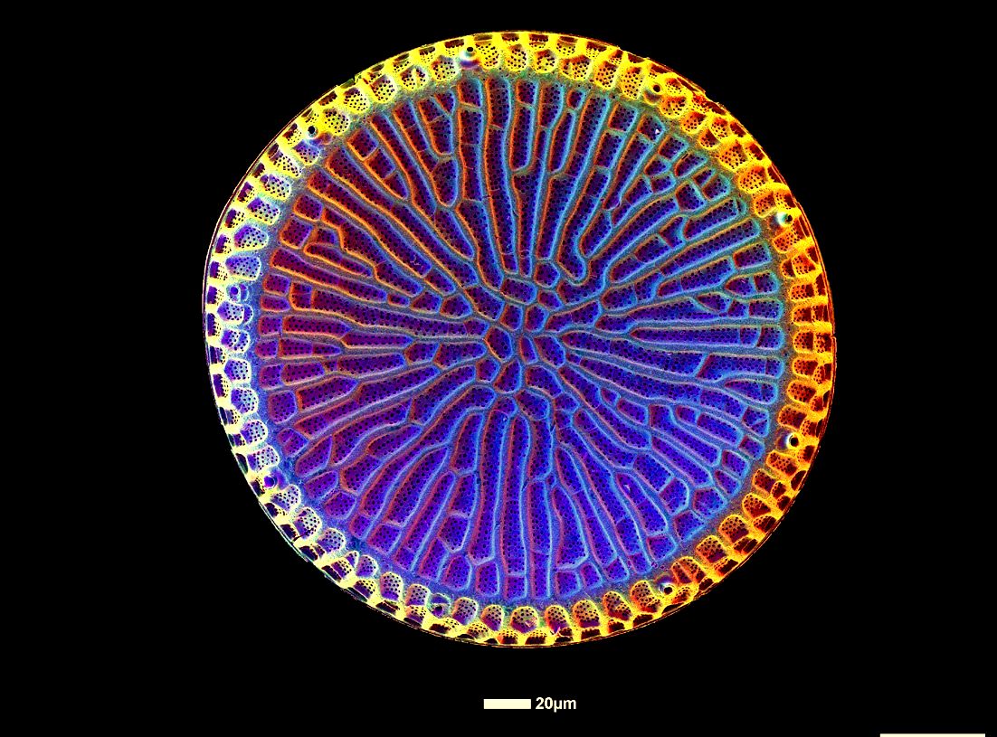 ::B L O G H I S T A∙P E R∙C A S O:: : Diatoms ~ Diatomeen ~ Diatomées ...