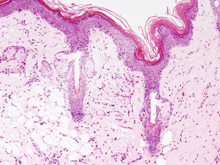 ESTRUCTURA HISTOLÓGICA DE LA PIEL