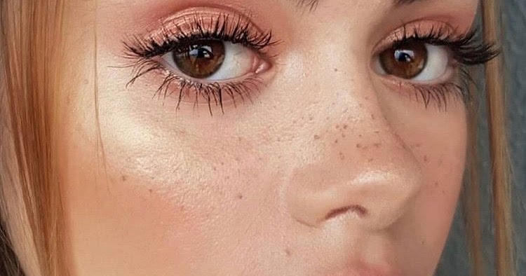 Sedih Lihat Filter Freckles yang Bikin Cantik, Ketika Punya Freckles ...