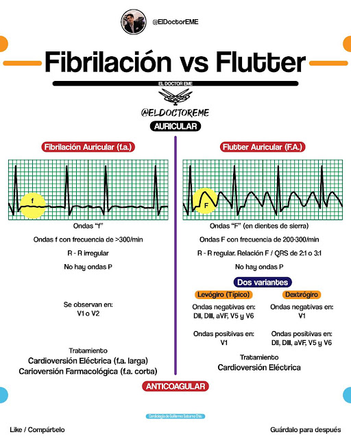 ZONA DE SALUD DE OFRA: FIBRILACIÓN VS FLUTTER AURICULAR.