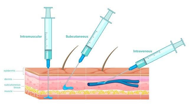 What are Intravenous, Intramuscular, and Subcutaneous Injection ...