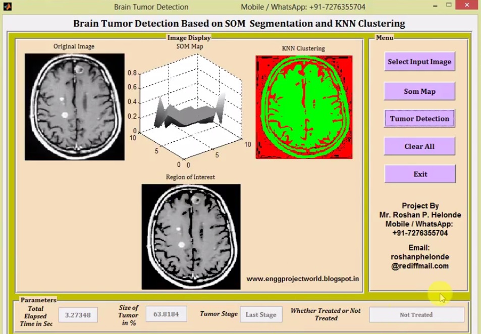 Brain Tumor Detection Using Som Segmentation And K