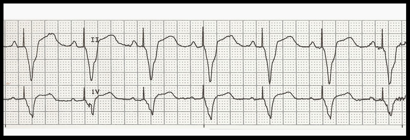 Practice EKG Rhythm Strips 213