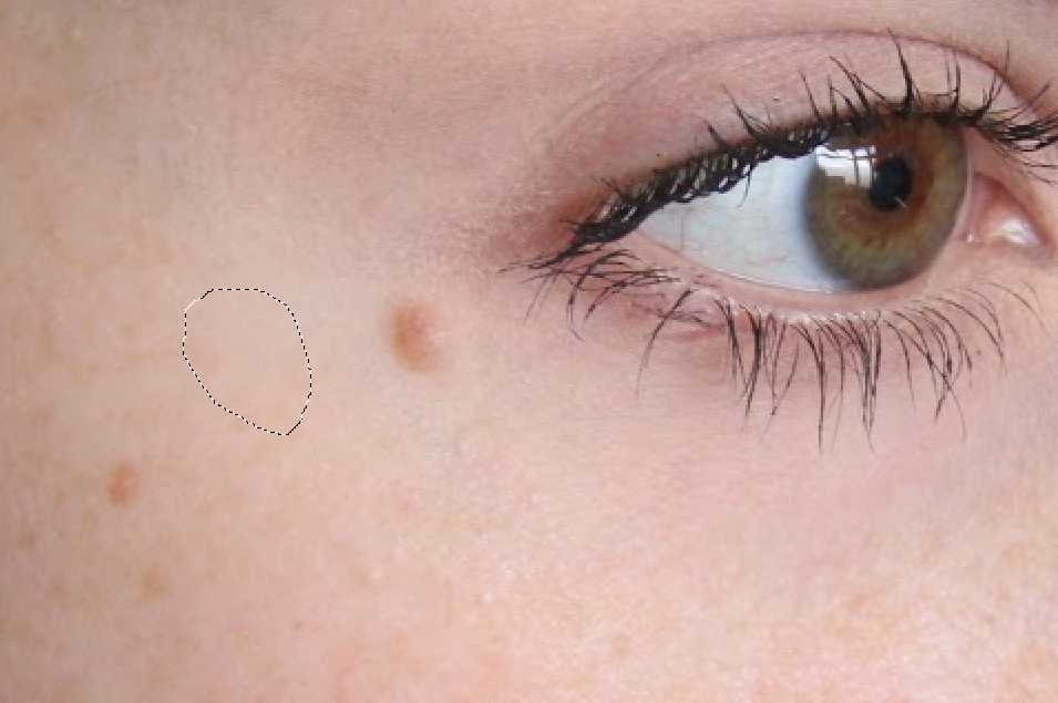 How To Remove Pimples And Sun Spots In Adobe Photoshop Free Of Cost how-to-remove-pimples-and-sun-spots-in-adobe-photoshop-free-of-cost
