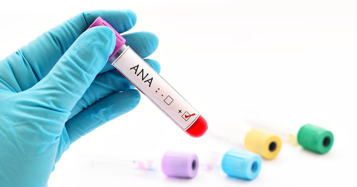 ANA Test ~ Lab Tests Guide