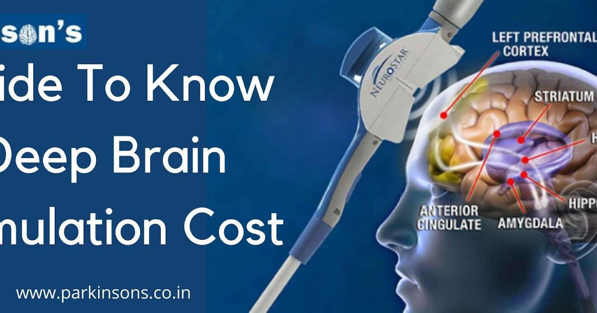 Information Of Deep Brain Stimulation Cost - Parkinsons.co.in