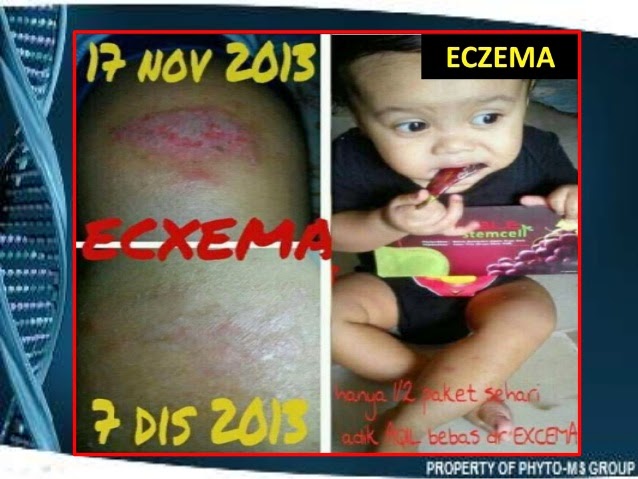 Phyto Science Stem Cell: Testimony for PhytoScience Double Stem Cell