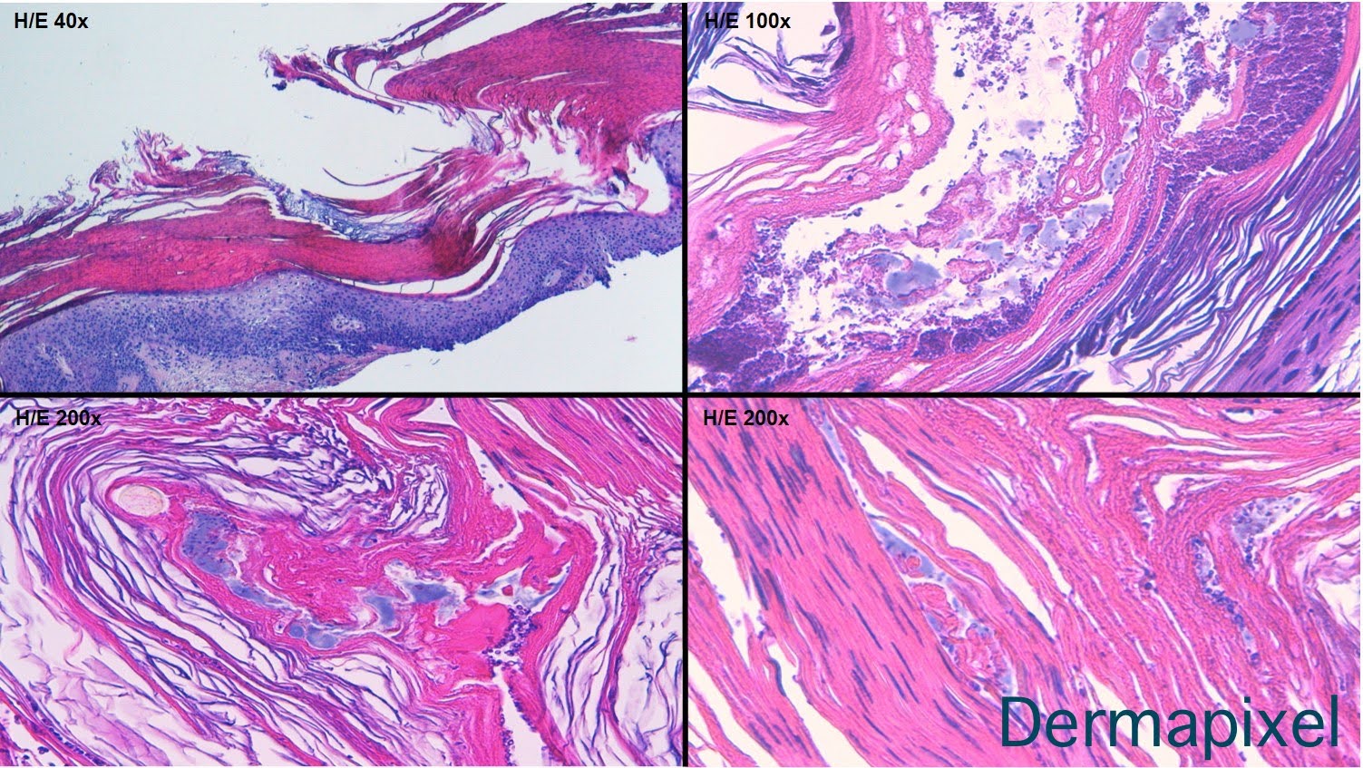 Dermapixel: noviembre 2020