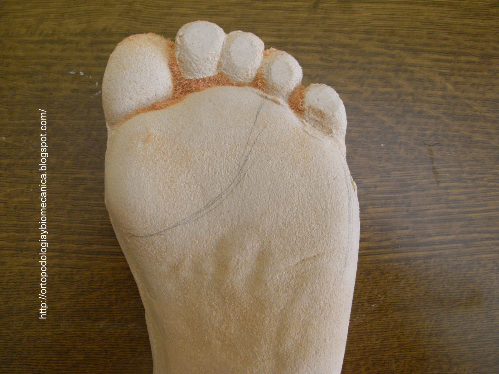 Ortopodologia y Biomecanica : “GAIT PLATE”. TRATAMIENTO METATARSO ADUCTO