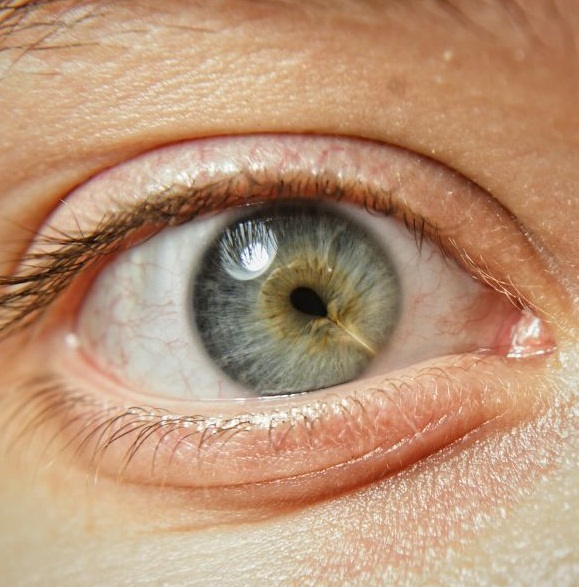 Unusual and Unique Body Features | Genetic Characteristics