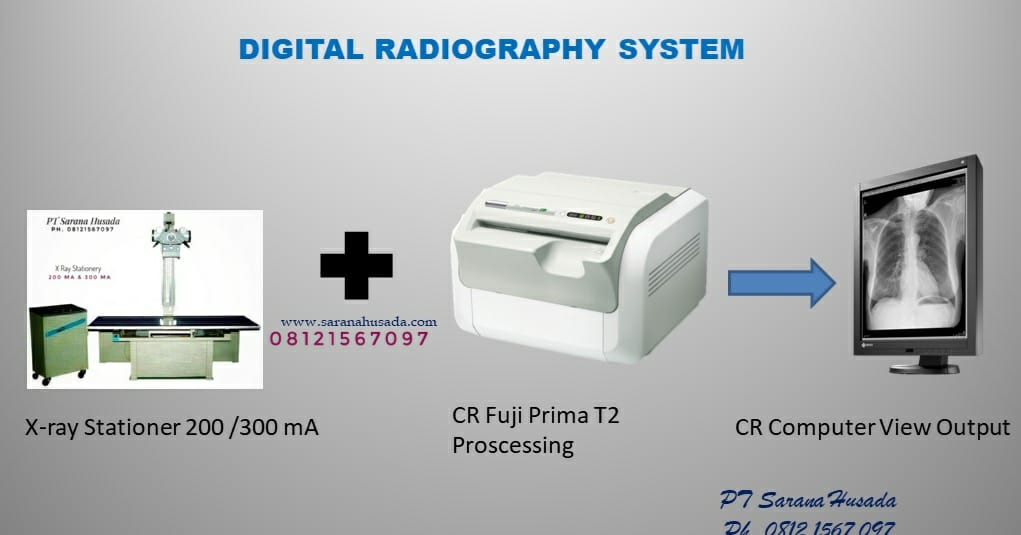 RADIOLOGY DIGITAL, Alat X RAY DILENGKAPI CR FUJI PRIMA T2 - ALAT X-RAY ...