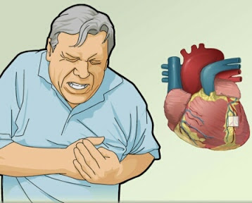 Angina pectoris And dental treatment protocol