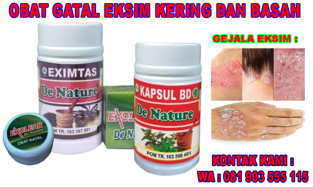 24 salep obat gatal eksim basah paling manjur di apotik