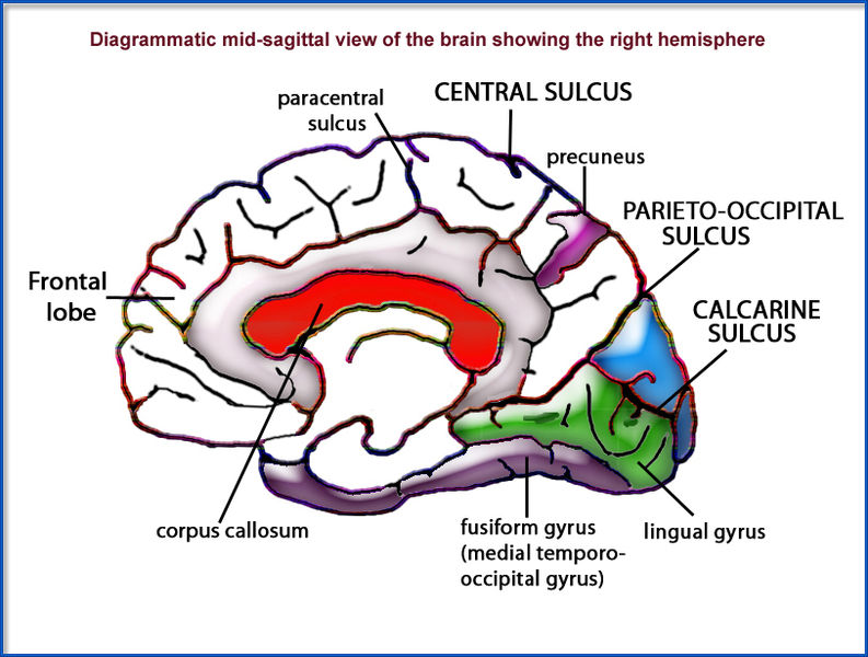 MADRES POR LA INTEGRACION ESCOLAR: Agenesia del cuerpo calloso