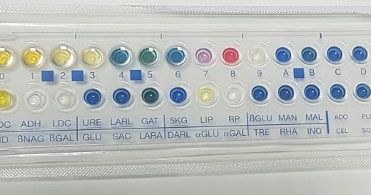 MICROBIOLOGÍA CLÍNICA: PRACTICA 18: ID 32 E