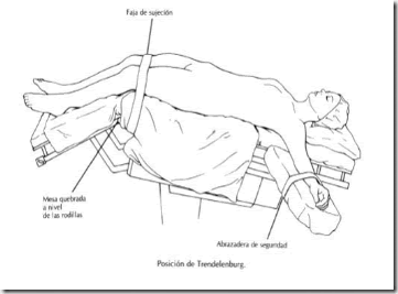 POSICION DE TRENDELENBURG