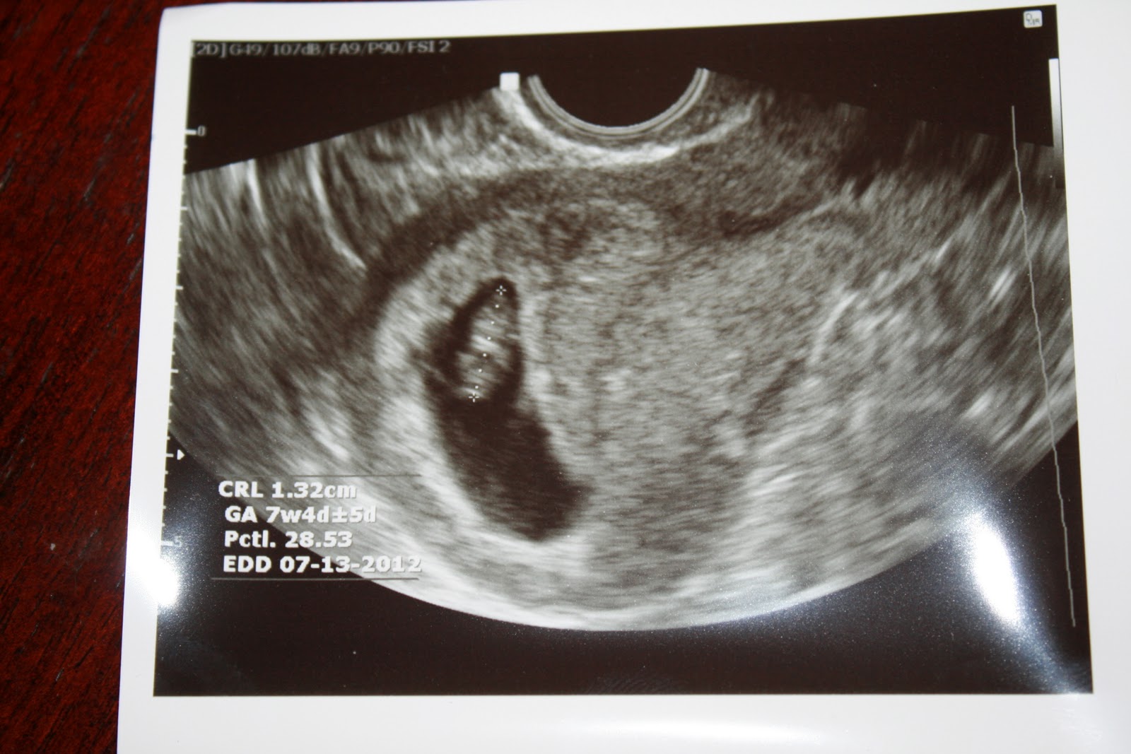 Finally Expecting!: 7 week 4 day ultrasound!
