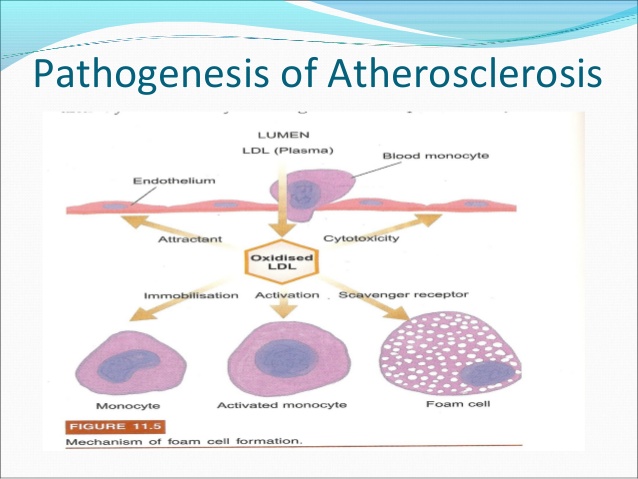 Pathophysiology Of Atherosclerosis