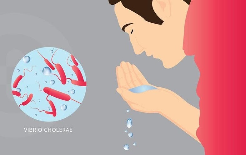 √ Penyakit Kolera : Penyebab, Gejala Dan Cara Pengobatannya - POROS KOMPAS