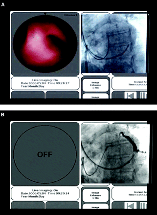 Dr Han Naung @ Henry Han : Electrophysiology and Heart Rhythm ...