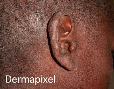 Dermapixel: enero 2020