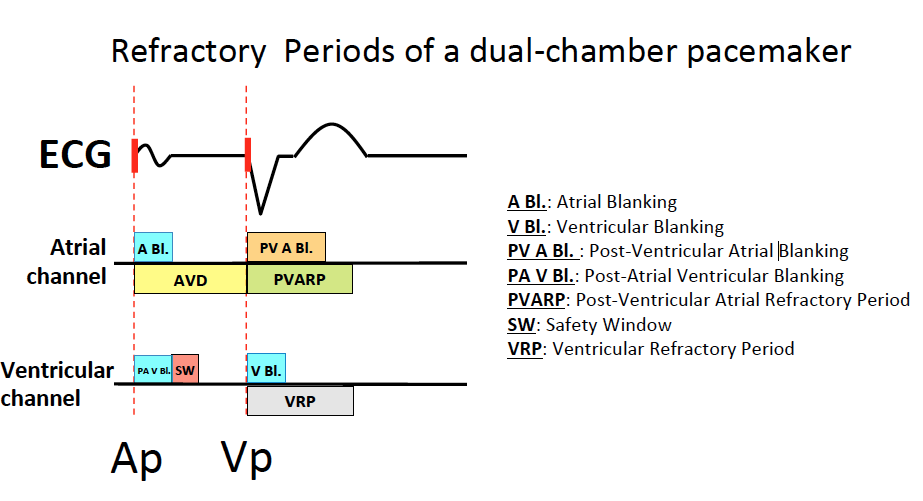 Dr Han Naung @ Henry Han : Electrophysiology and Heart Rhythm : AV ...
