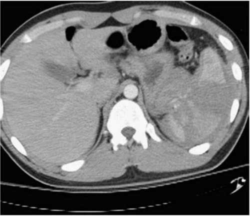 Blunt Trauma Case File