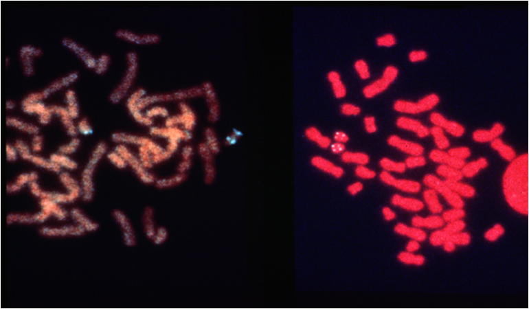 Dentistry and Medicine: DiGeorge Syndrome Lecture Note