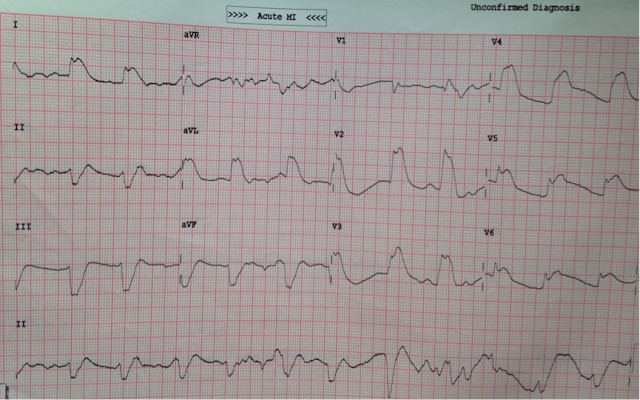 EM Didactic: Resuscitation: When do we call it off?